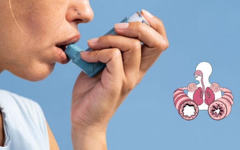 Asthma Causes and Treatment in Delhi, explained by a Pulmonologist
