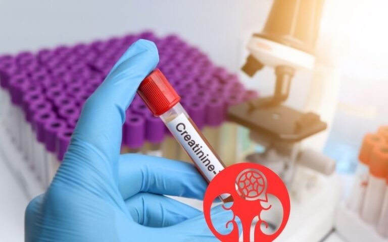 How much creatinine is safe for the kidneys? - Primus Super Specialty ...